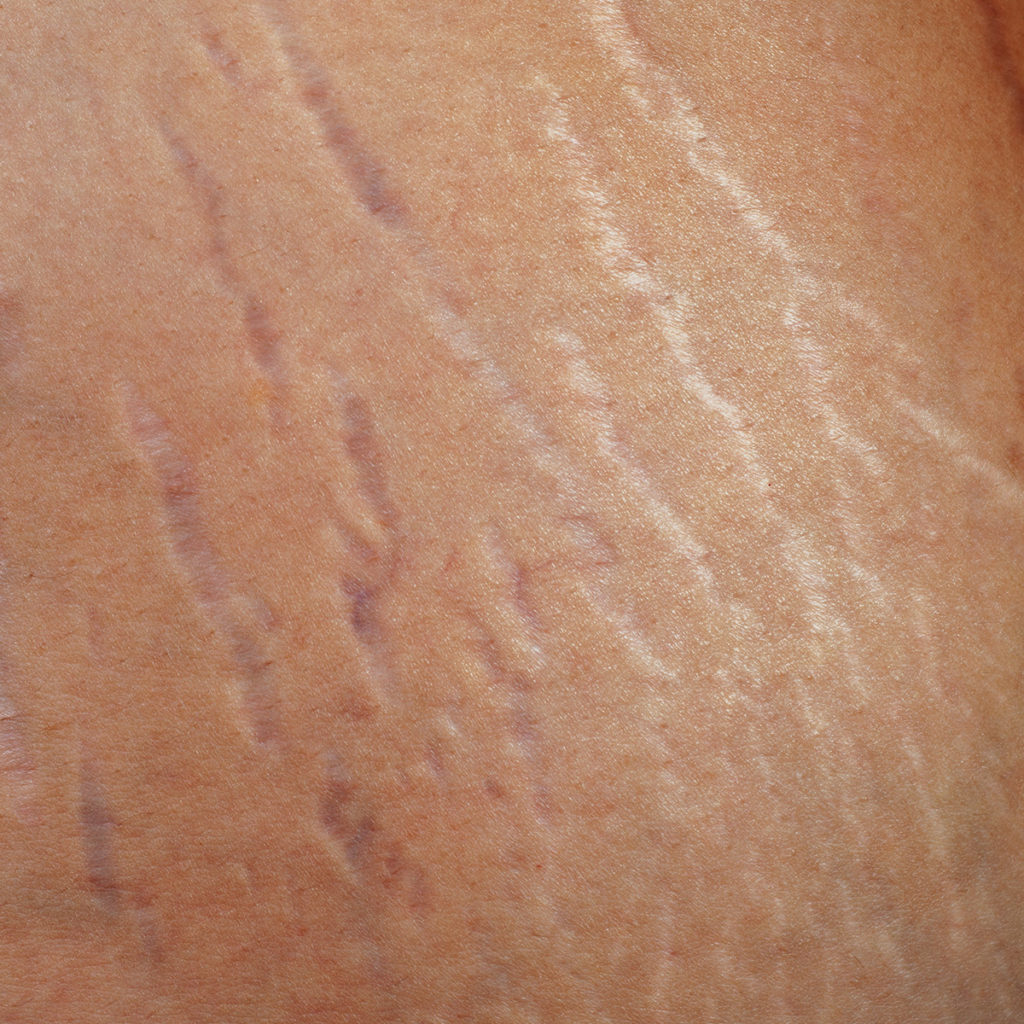 Tratamientos - Irradia